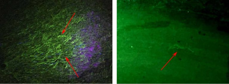 Formation of slag inclusion on the surface of nodular cast iron ...